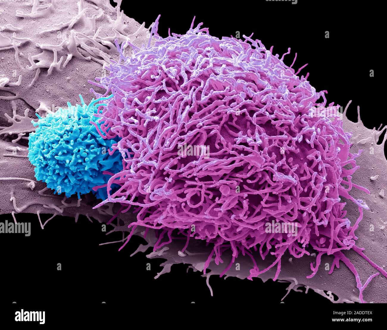 Natural killer (NK) cell interacting with hepatoma cell (HepG2 ...