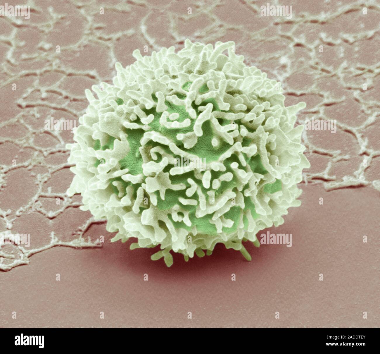 Natural killer (NK) cell, coloured scanning electron micrograph (SEM ...