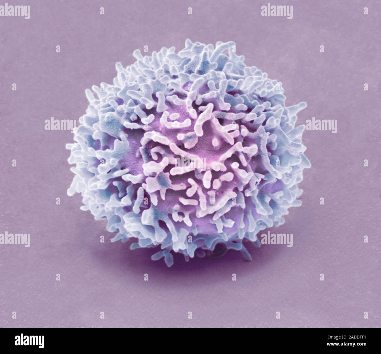 Natural killer (NK) cell, coloured scanning electron micrograph (SEM ...
