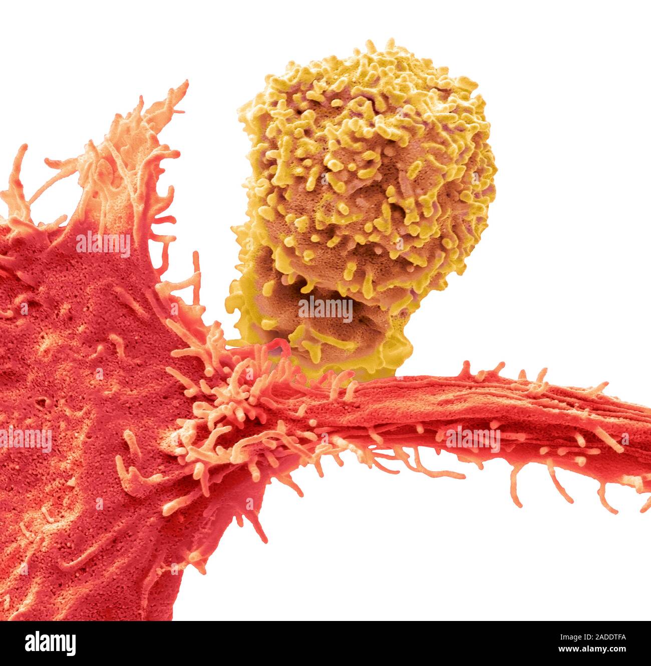 Natural killer (NK) cell interacting with hepatoma cell (HepG2 ...