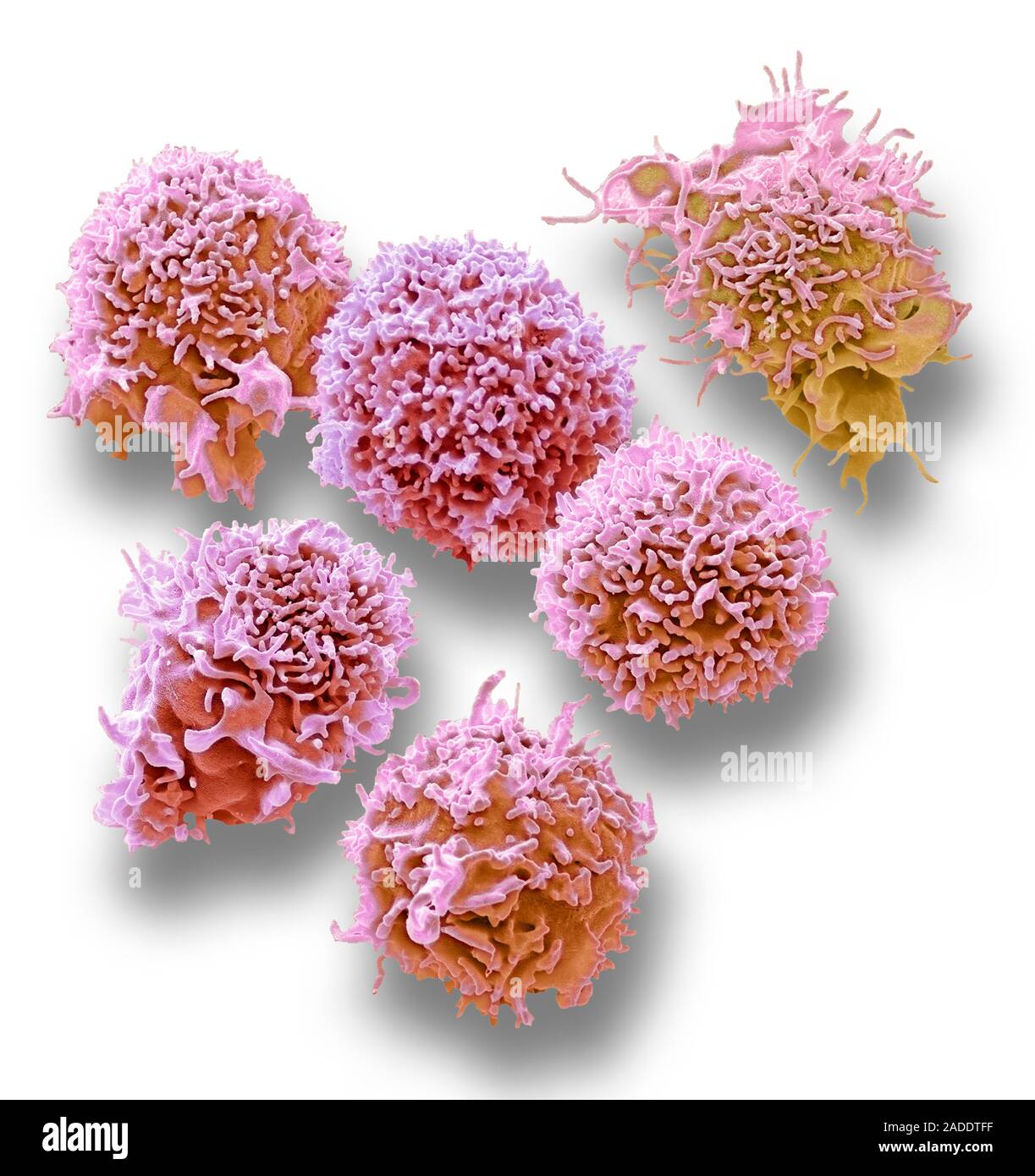 Natural killer (NK) cells, coloured scanning electron micrograph (SEM ...