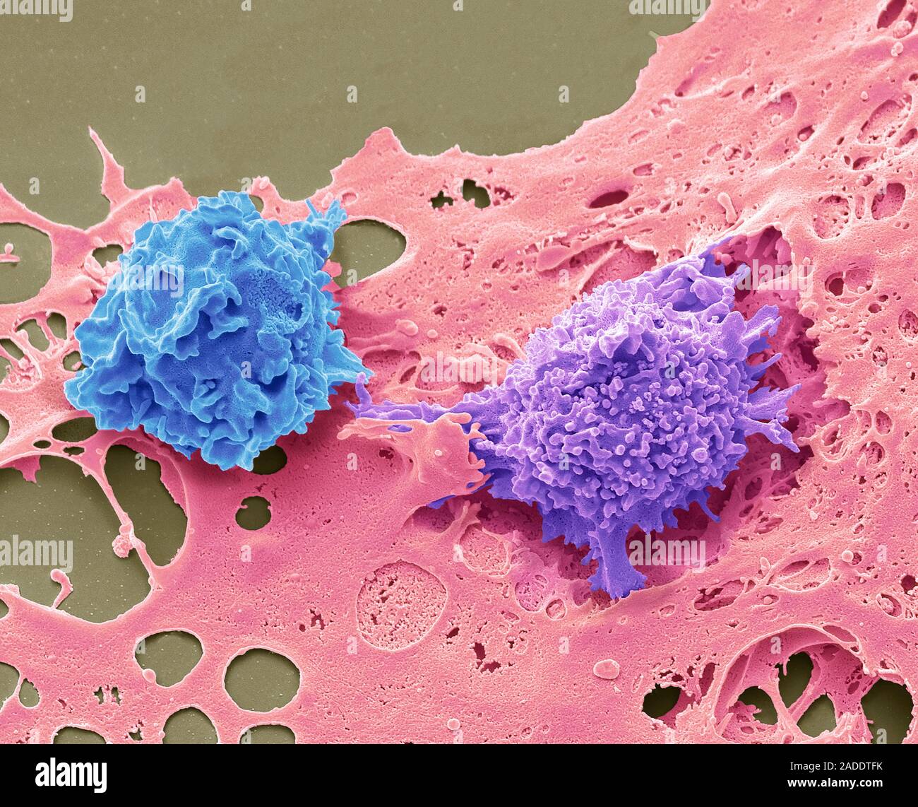 Coloured scanning electron micrograph (SEM) show natural killer cells ...