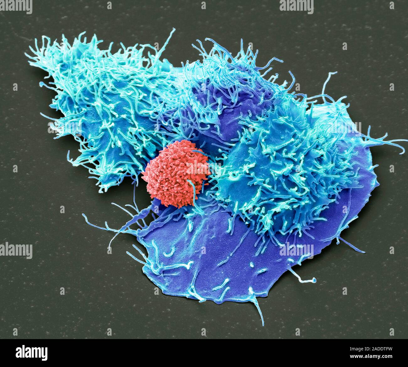 Natural killer (NK) cell interacting with hepatoma cell (HepG2 ...