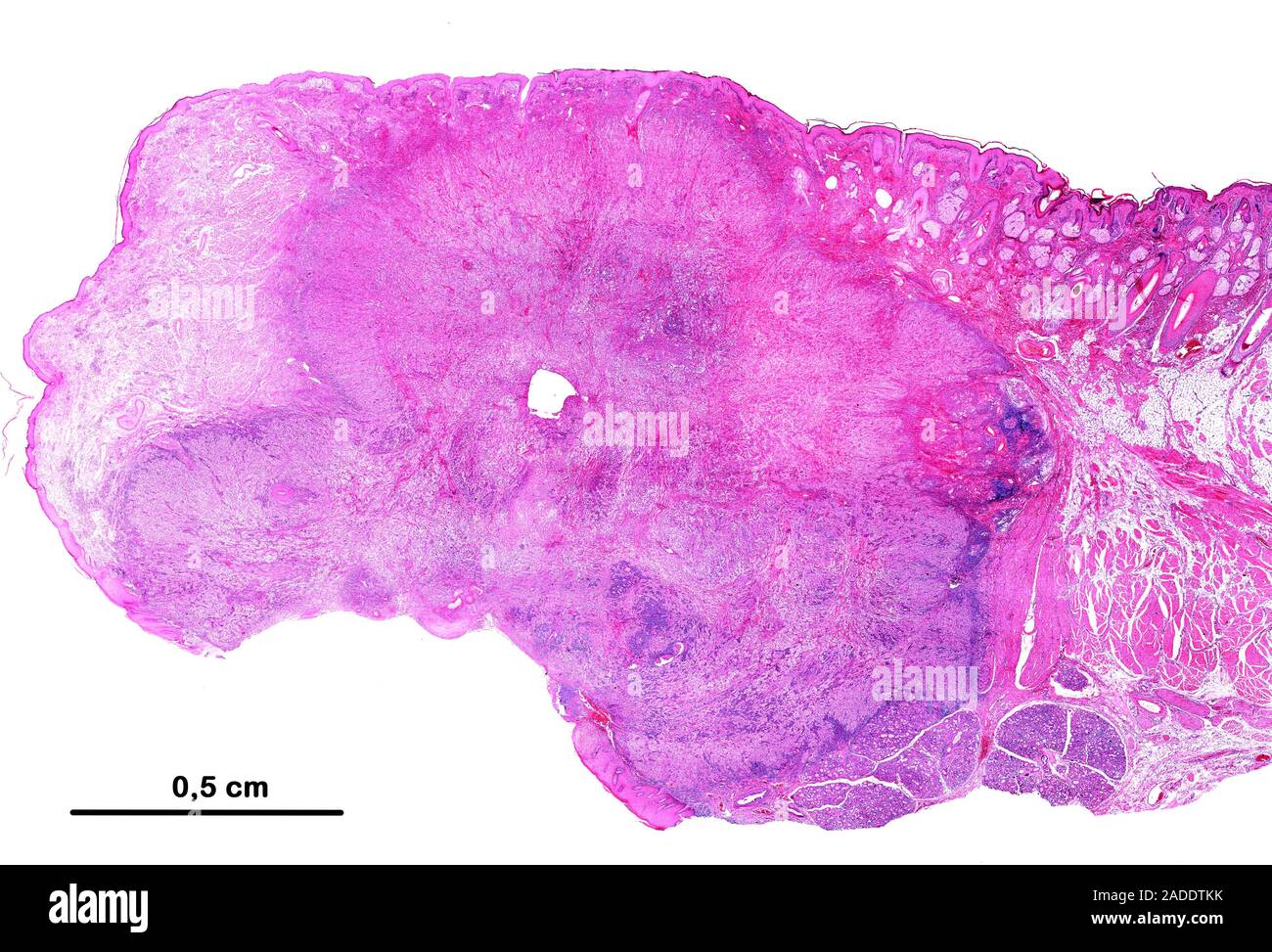 Light micrograph showing a section of a full lip. The skin surface ...