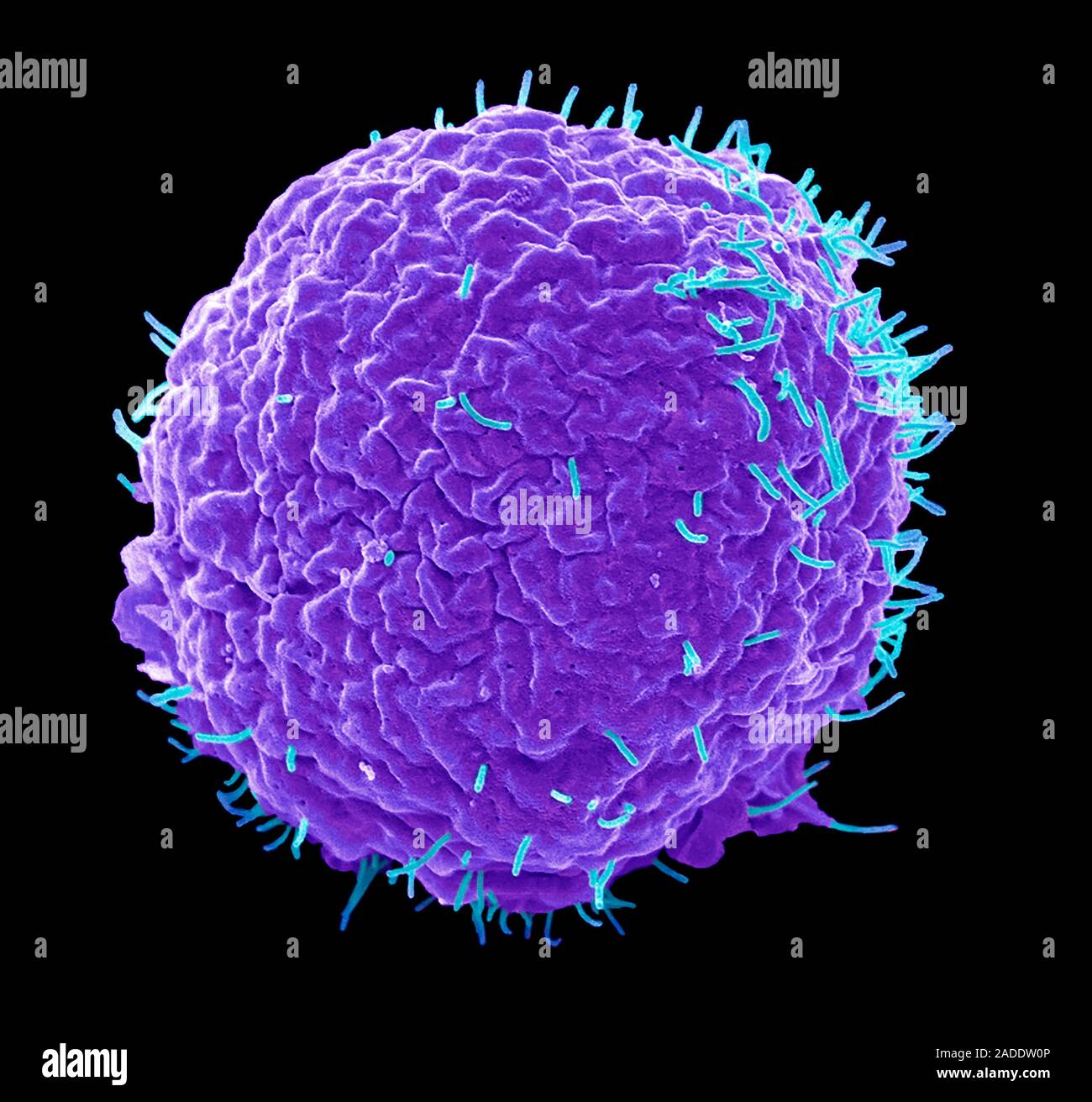 Human cells infected with influenza virus, coloured scanning electron ...