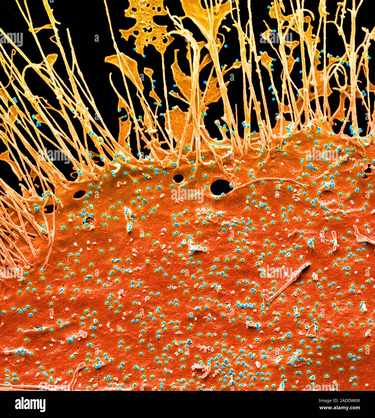 HIV infected 293T cell. Coloured scanning electron micrograph (SEM) of ...