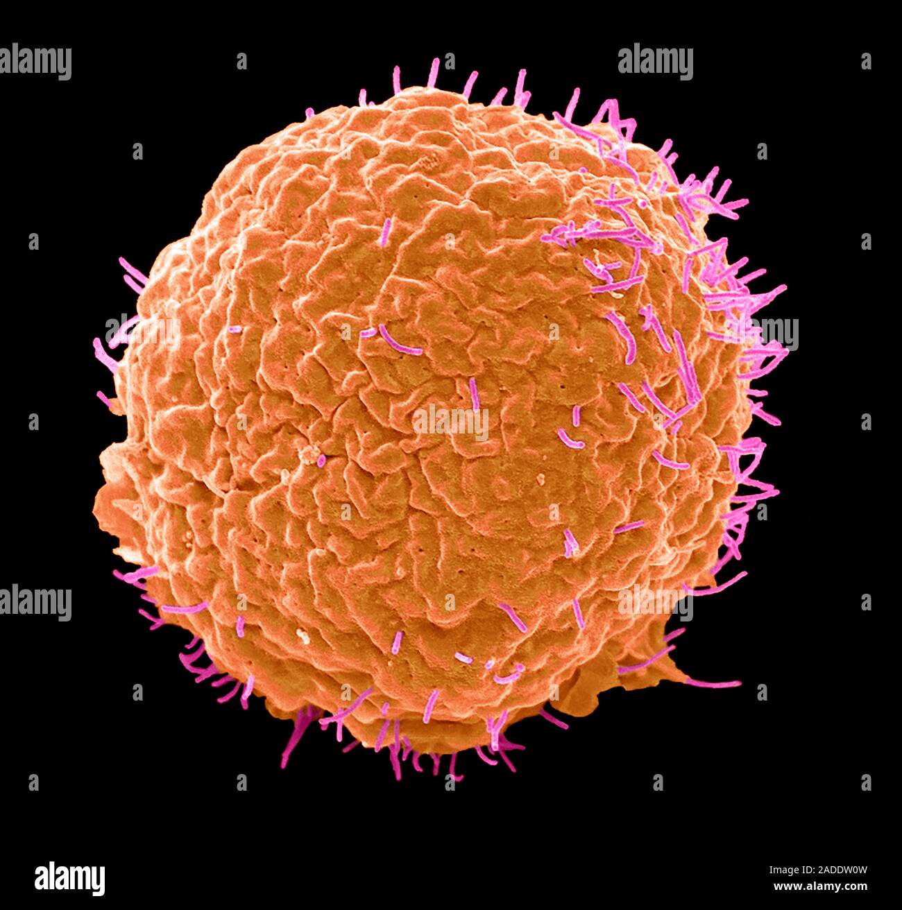 Human cells infected with influenza virus, coloured scanning electron ...