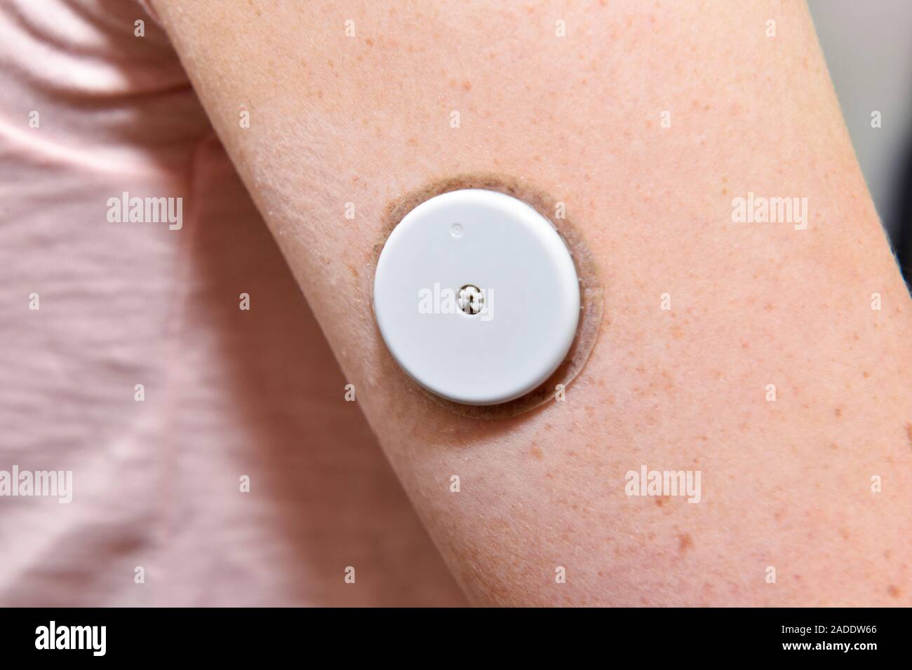 Wireless blood sugar monitor. Close-up of a FreeStyle blood glucose ...