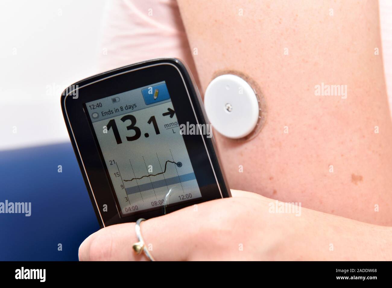Wireless blood sugar monitor. Close-up of a FreeStyle blood glucose ...