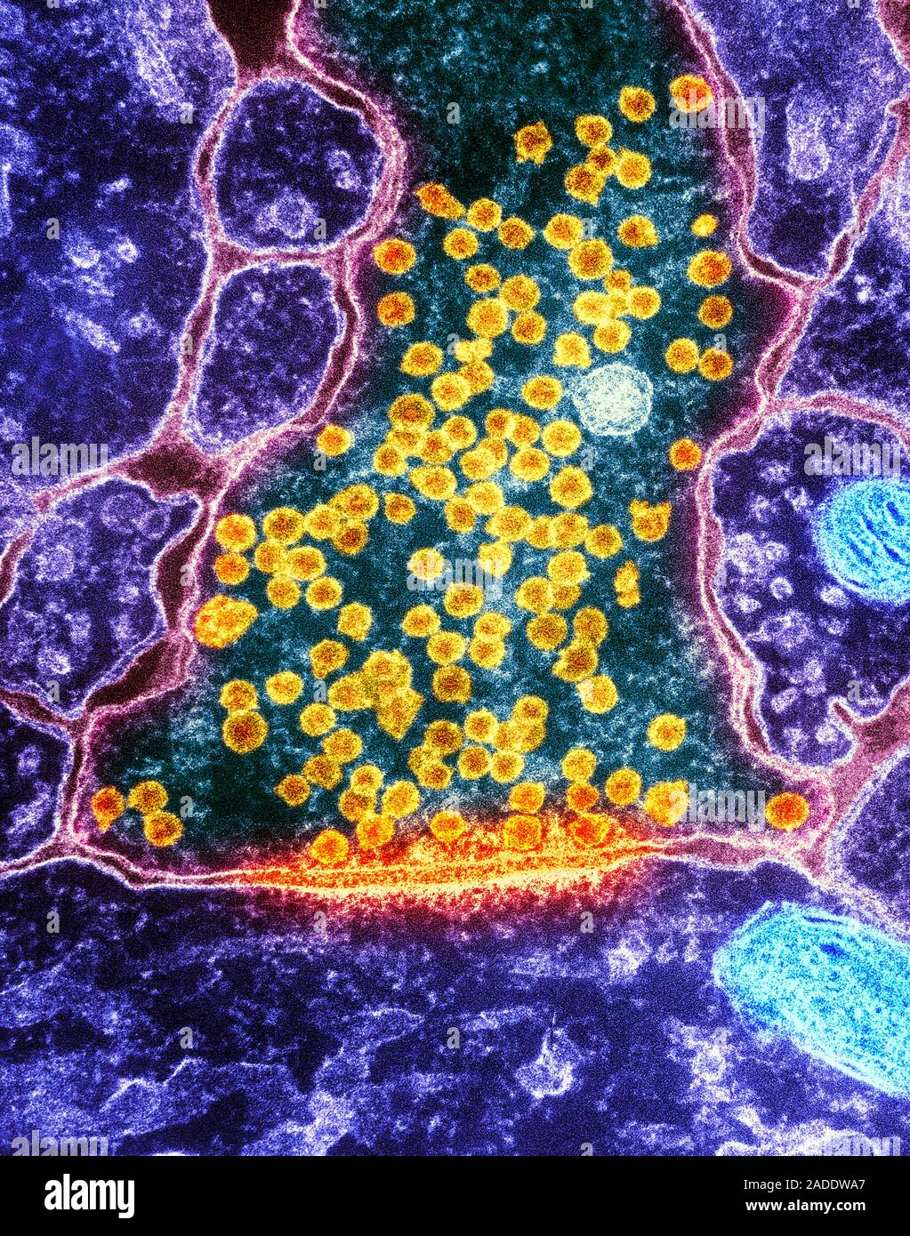 Excitatory synapse from the human central nervous system, coloured ...