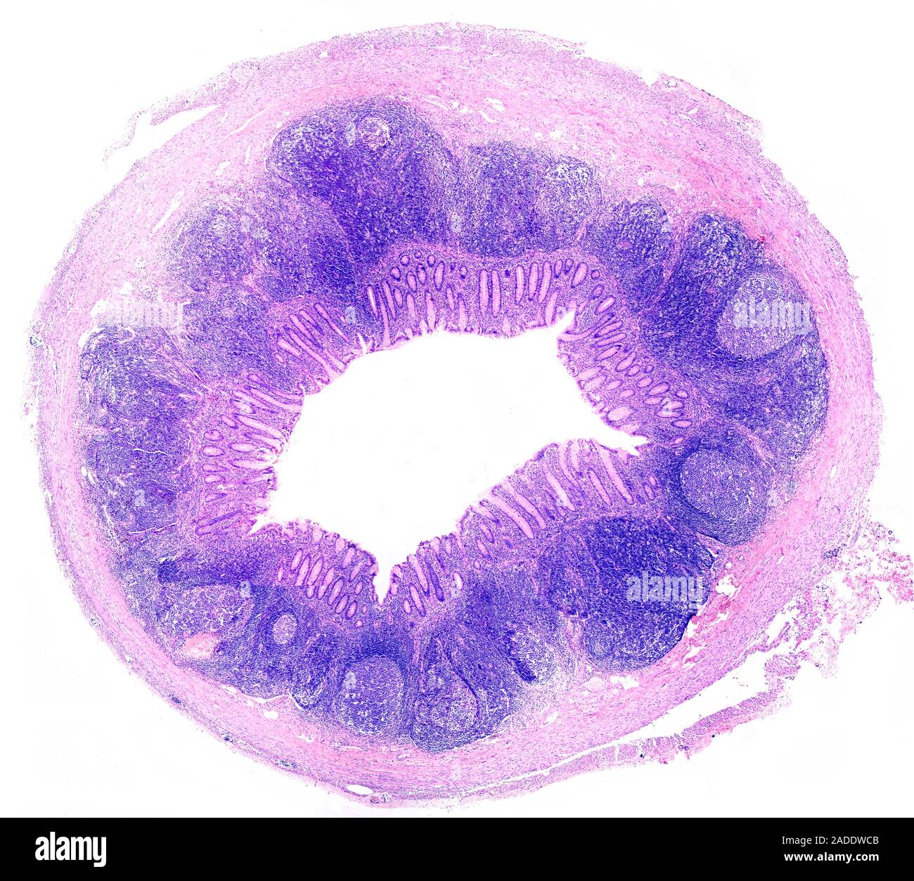 Vermiform Appendix Histology