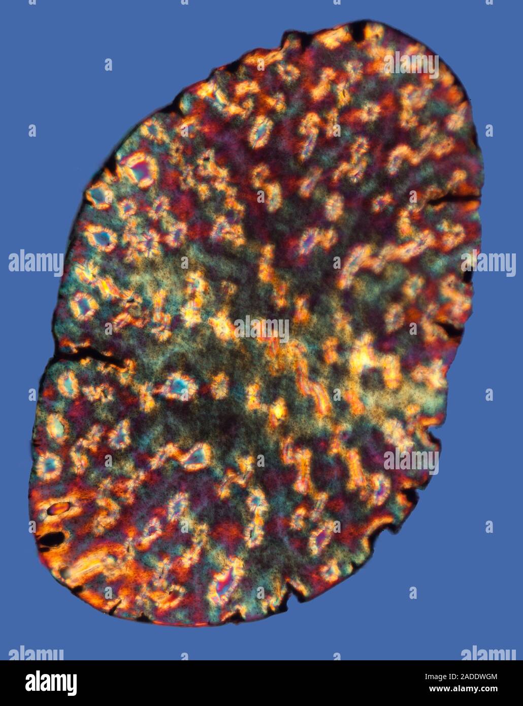 Polarised light micrograph of a cross-section of an elephant hair ...