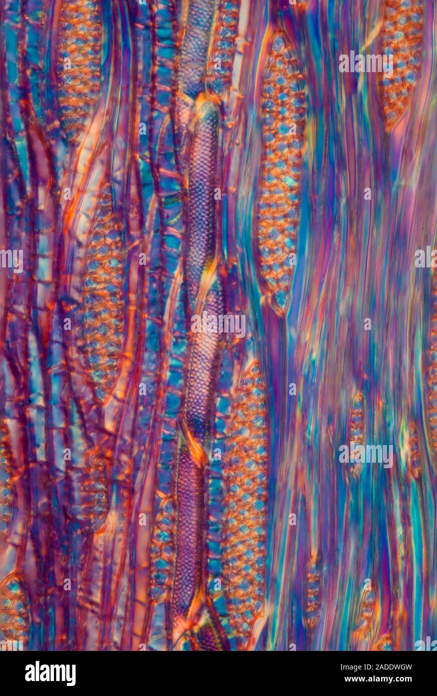 Polarised light micrograph of a tangential section of the mature wood ...
