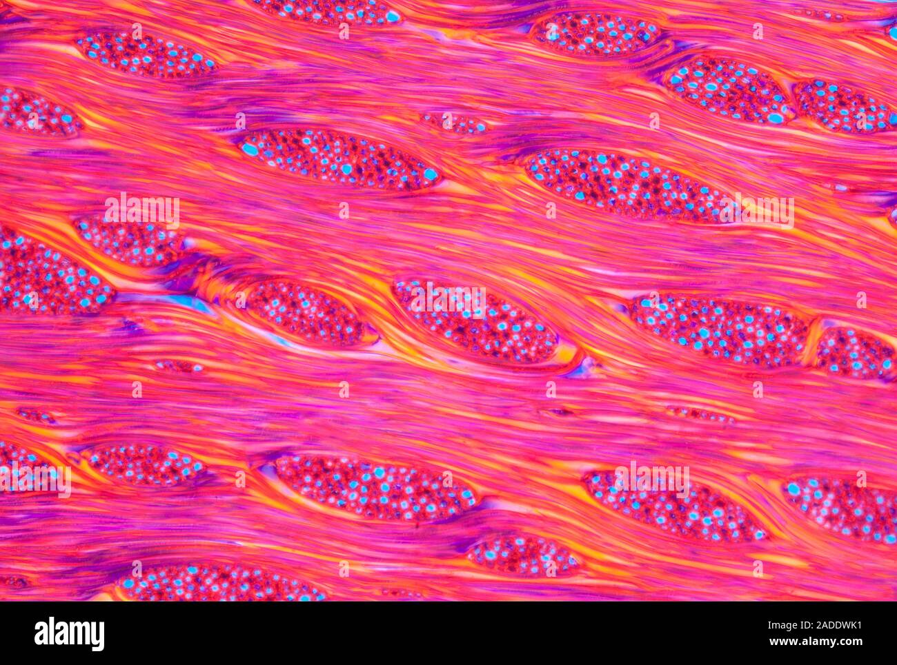 Polarised light micrograph of a tangential section of the mature wood ...