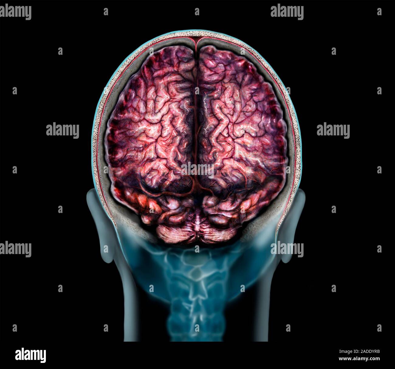 Normal brain. Cutaway computer illustration of a section through a ...