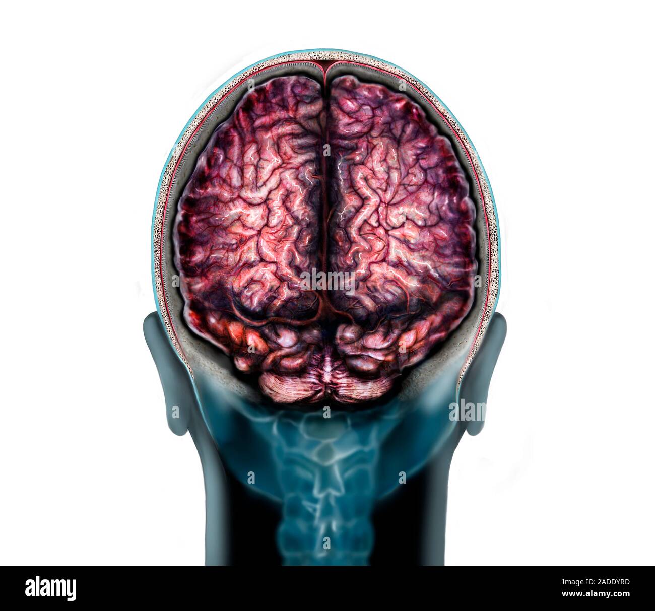 Normal brain. Cutaway computer illustration of a section through a ...