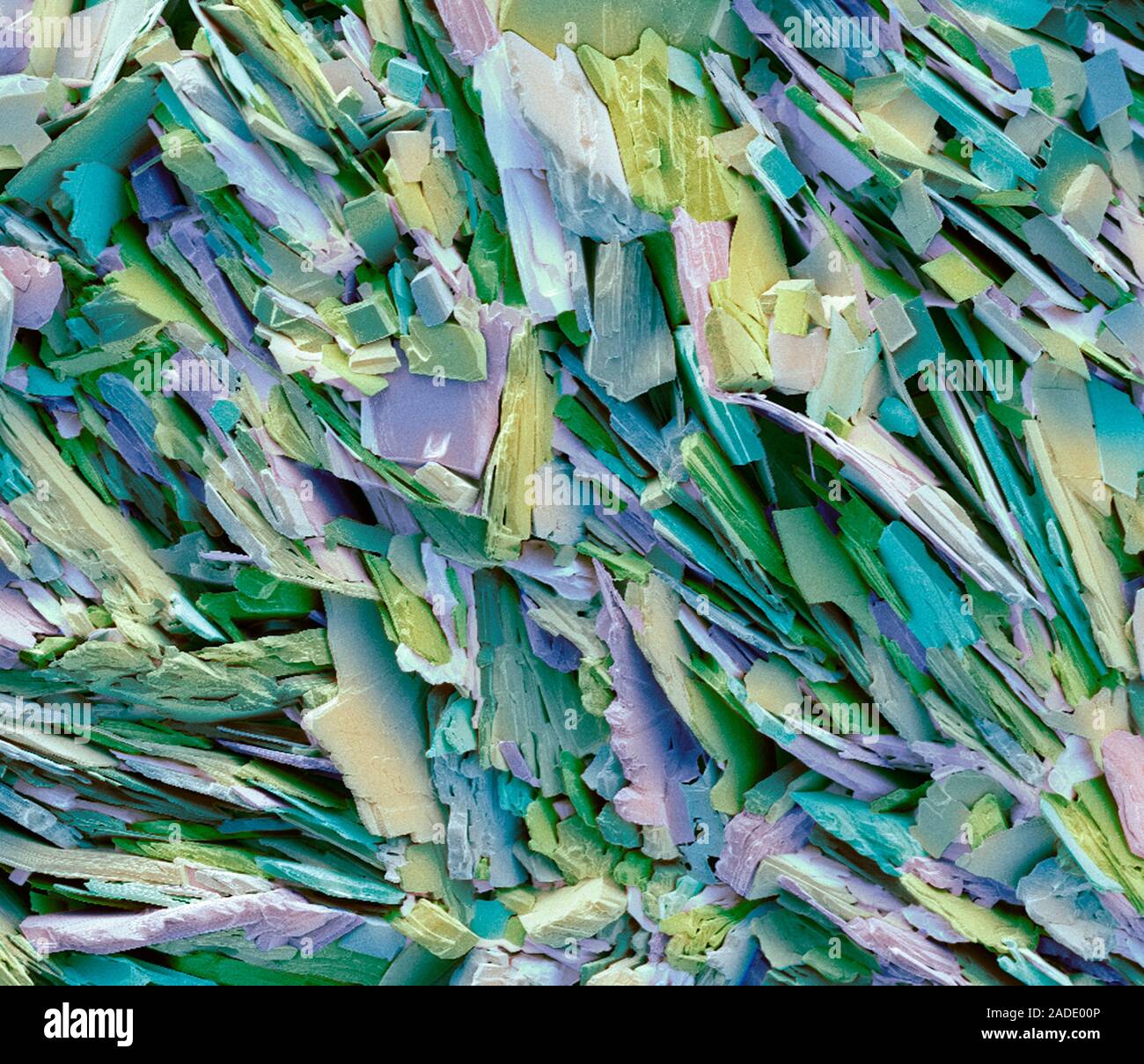 Gallstone crystals. Coloured scanning electron micrograph (SEM) of the ...