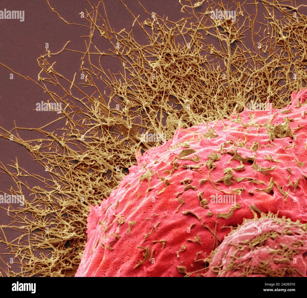 Coloured scanning electron micrograph (SEM) of a human cell infected ...