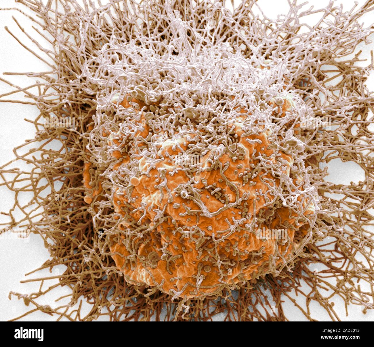 Jurkat cell. Coloured scanning electron micrograph (SEM) of a Jurkat ...