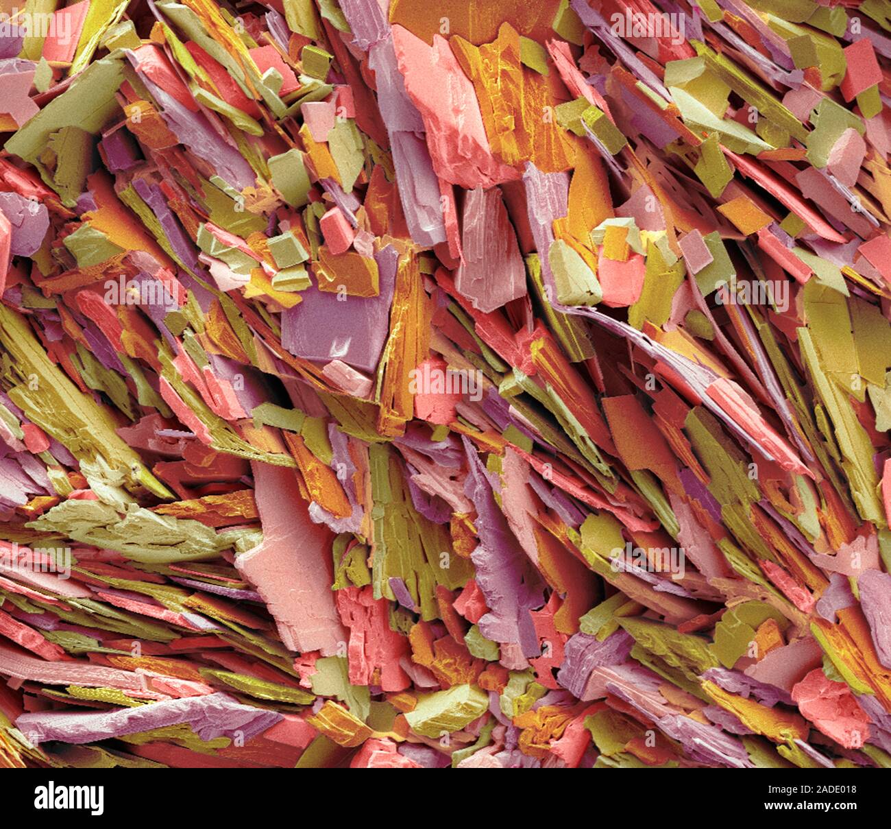 Gallstone crystals. Coloured scanning electron micrograph (SEM) of the ...