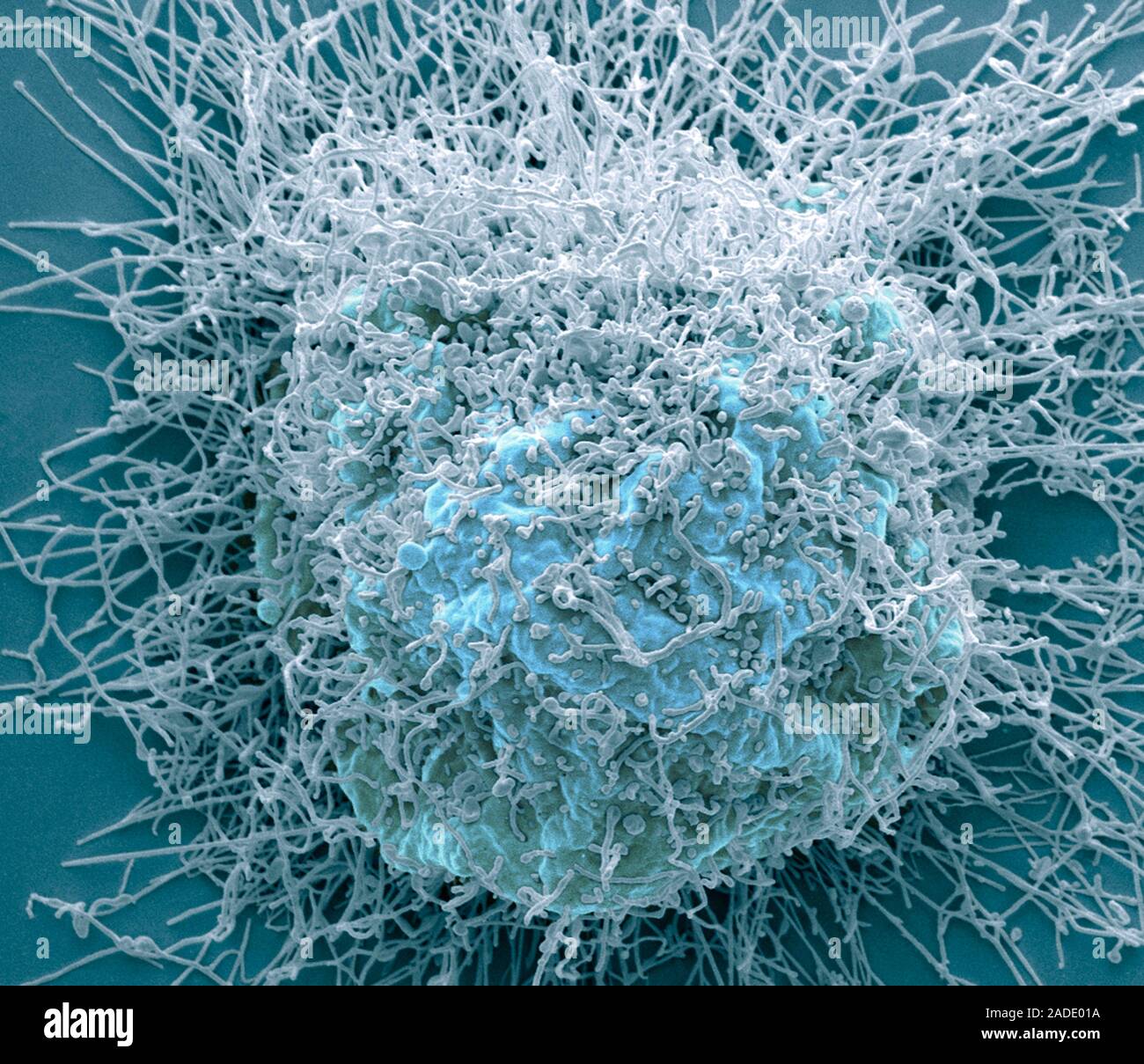 Jurkat cell. Coloured scanning electron micrograph (SEM) of a Jurkat cell. The Jurkat cell line ...