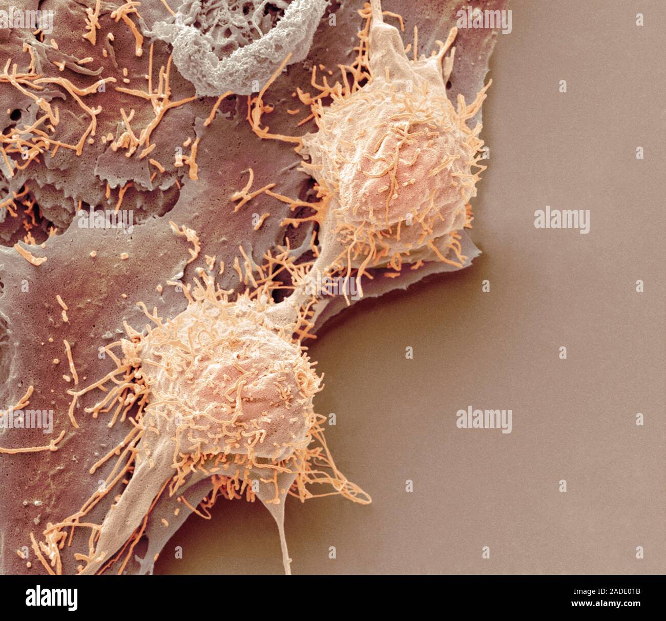 Natural killer (NK) cells interacting with hepatoma cell (HepG2 ...