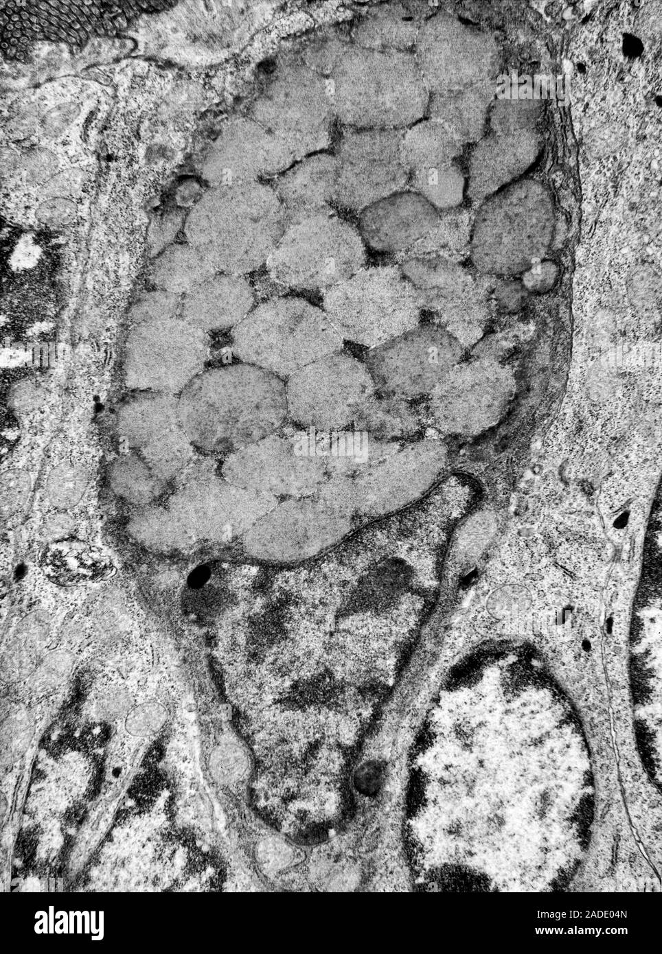 False colour transmission electron micrograph (TEM) showing a goblet ...