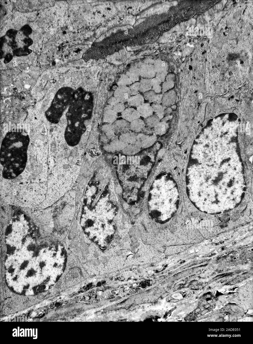 Transmission electron micrograph (TEM) showing the intestinal ...