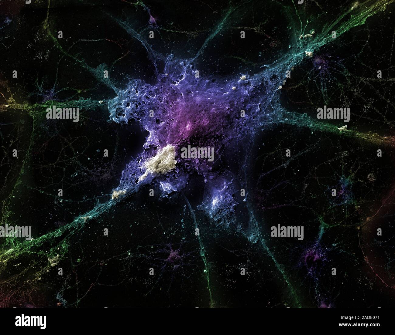 Coloured scanning electron micrograph (SEM) of a mouse (Mus musculus ...