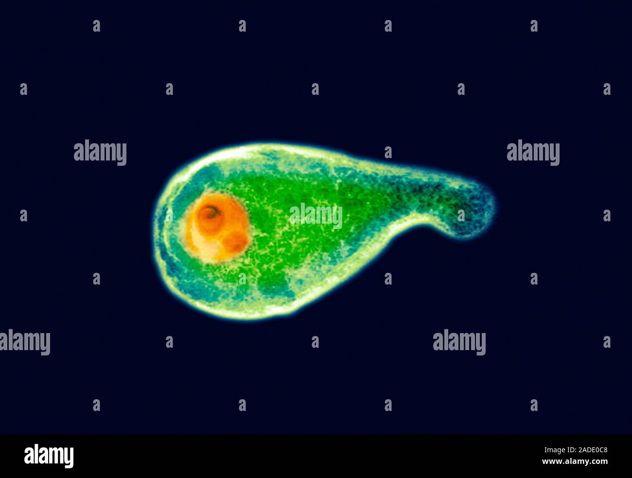 Mycoplasma genitalium bacterium, coloured transmission electron ...