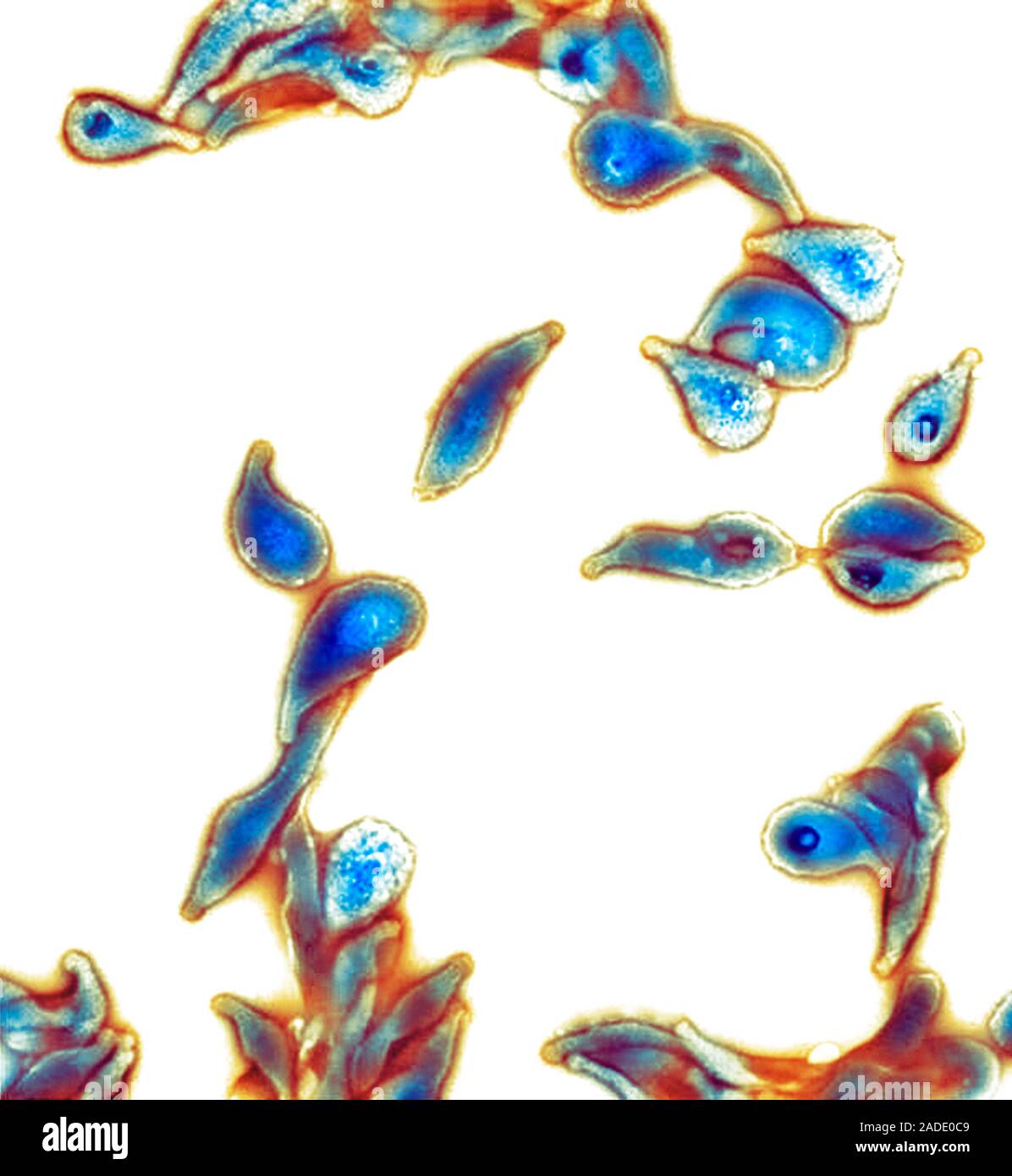 Mycoplasma genitalium bacteria, coloured transmission electron ...