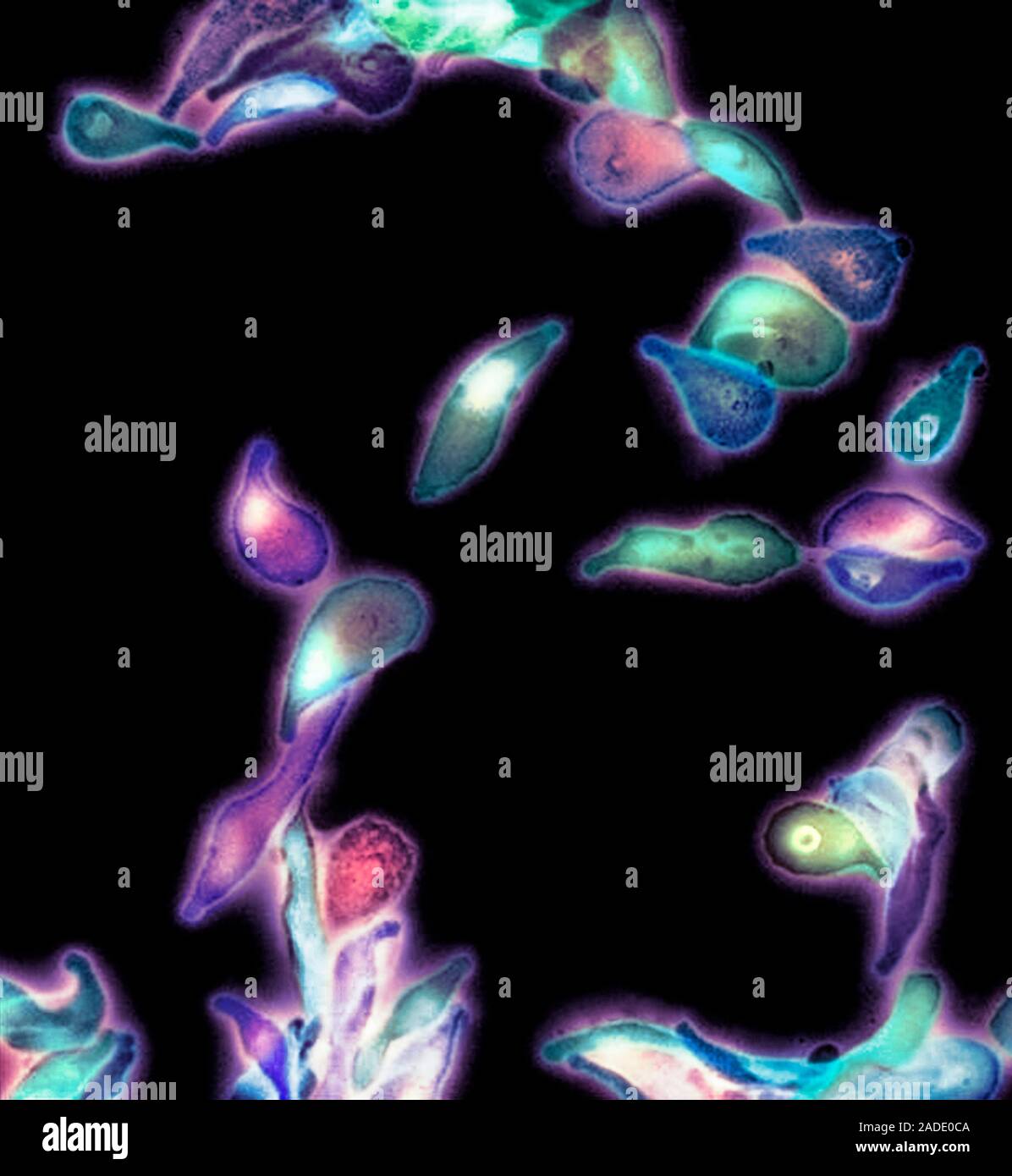 Mycoplasma genitalium bacteria, coloured transmission electron ...