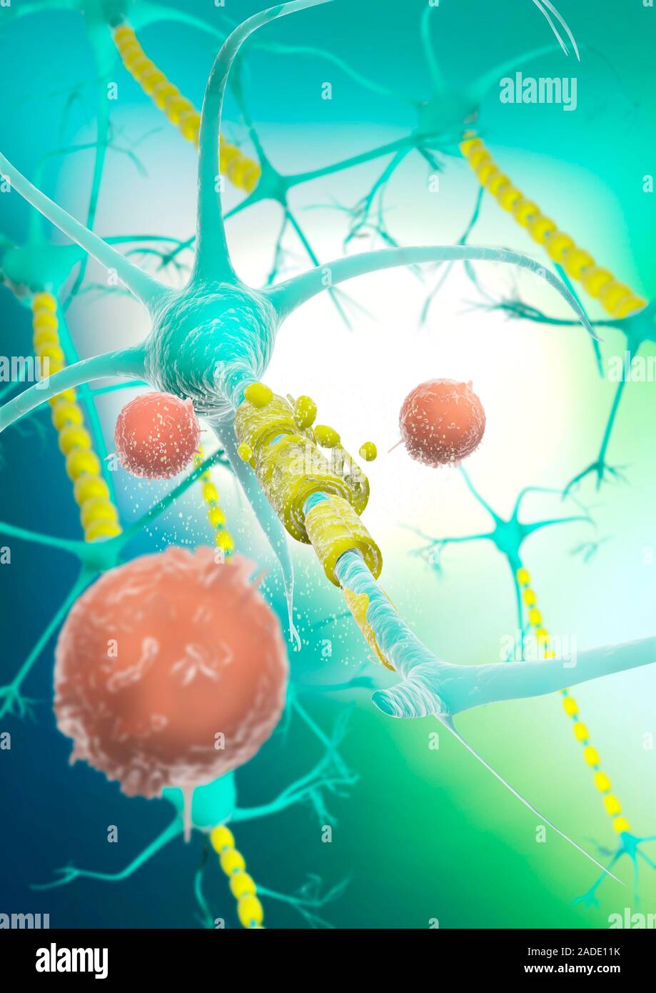 Lymphocytes attacking brain neuroglia. Illustration of lymphocytes ...