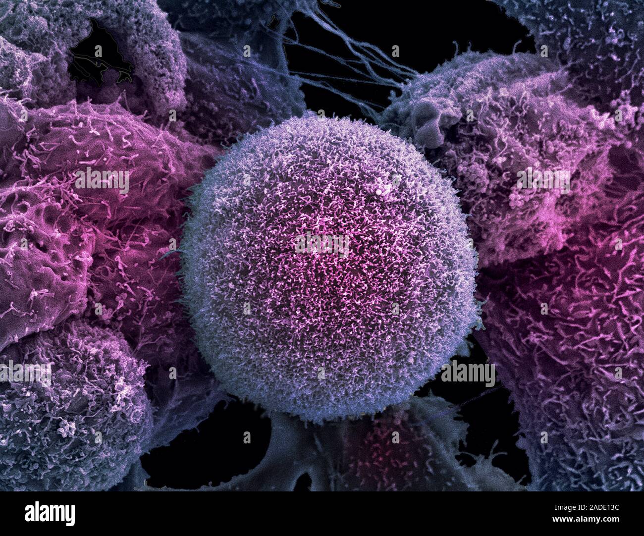 Images not to be used by the tobacco industry. Prostate cancer cells ...