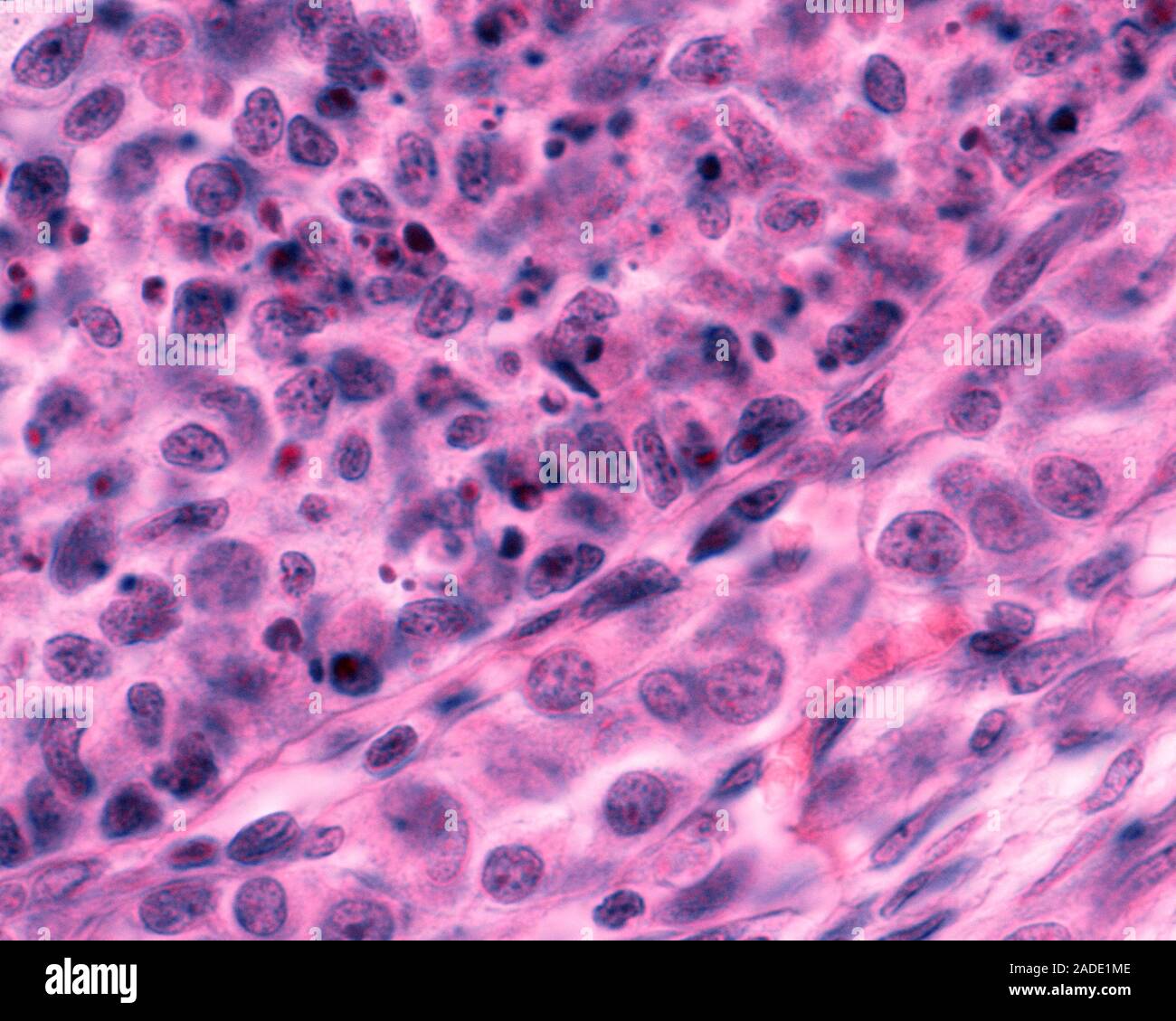 High magnification light micrograph of a tertiary ovarian follicle ...