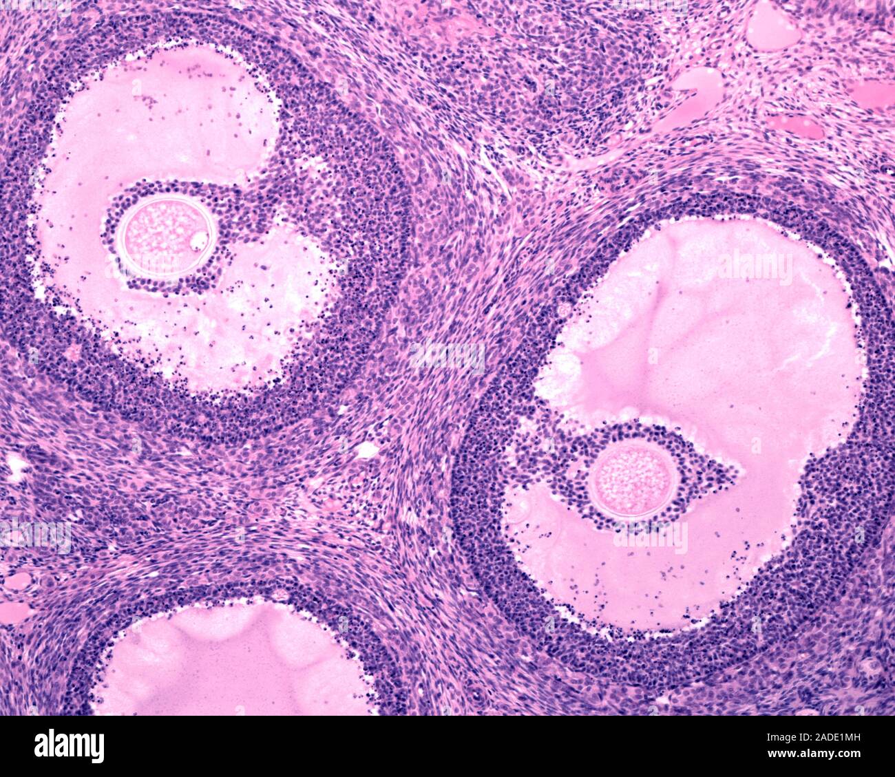 Low magnification light micrograph showing three tertiary atretic ...