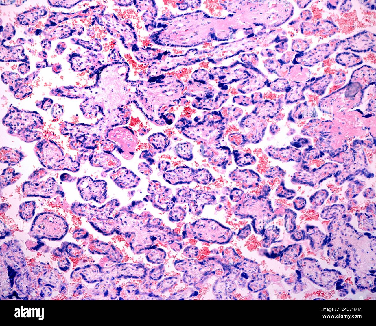 Light micrograph of a human placenta at term showing small chorionic ...