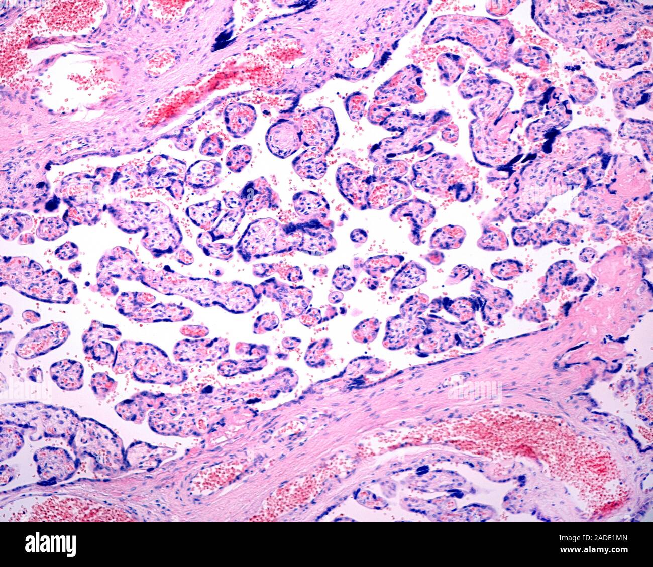 Light micrograph of a human placenta at term showing small chorionic ...