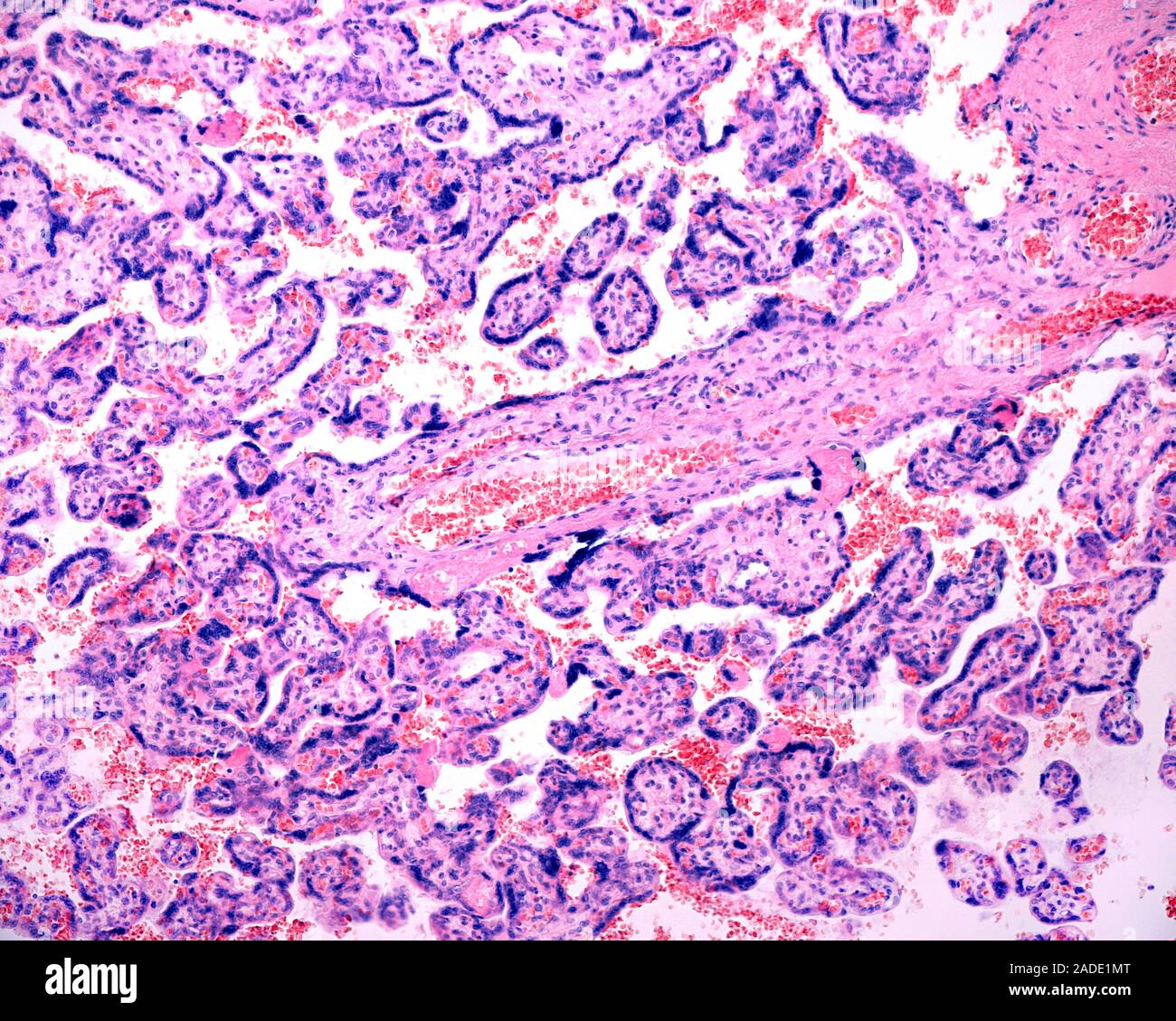 Light micrograph of a human placenta at term showing small chorionic ...