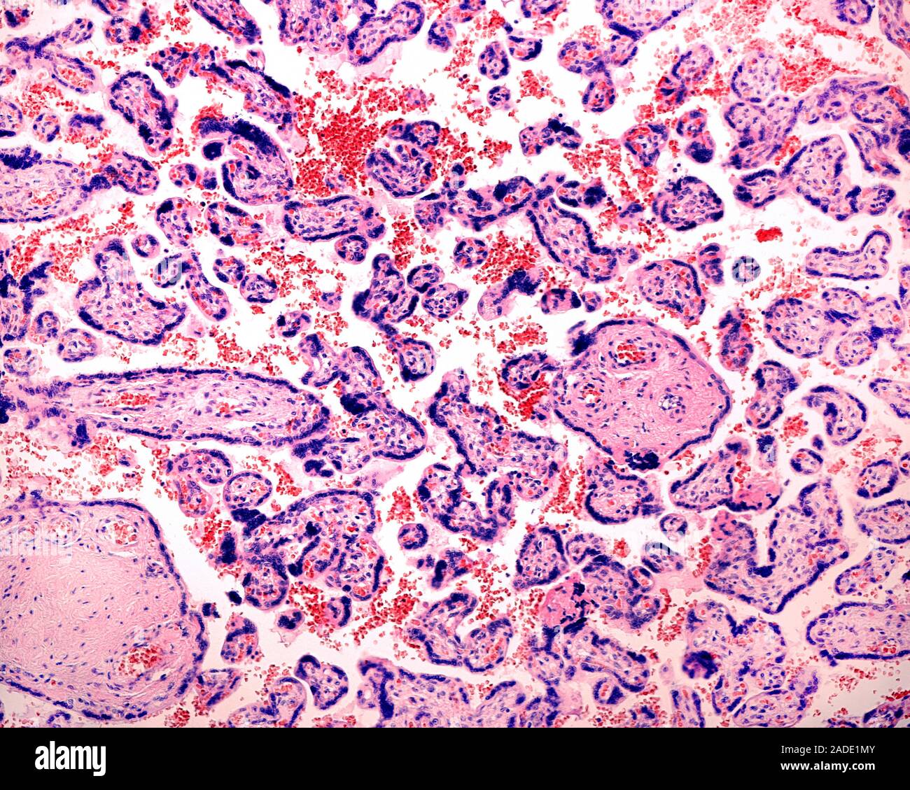 Light micrograph of a human placenta at term showing small chorionic ...