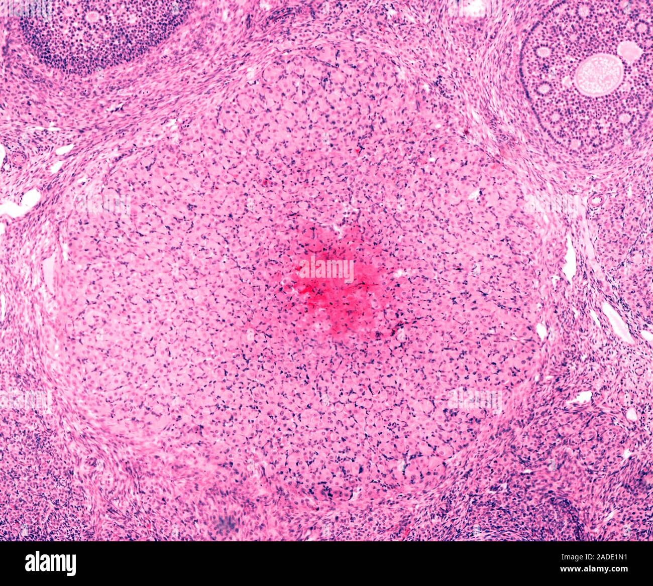 Low magnification light micrograph of a rabbit ovary showing a corpus ...
