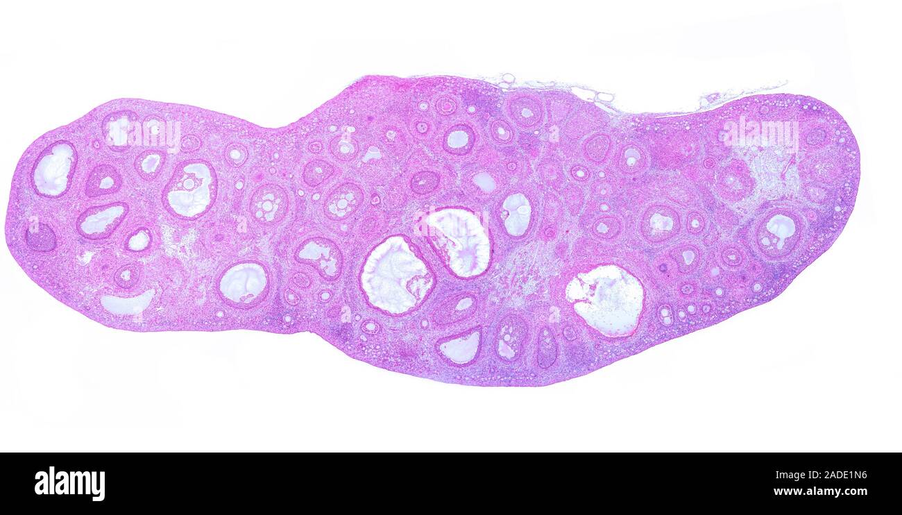 Low magnification light micrograph of a rabbit ovary showing the ...