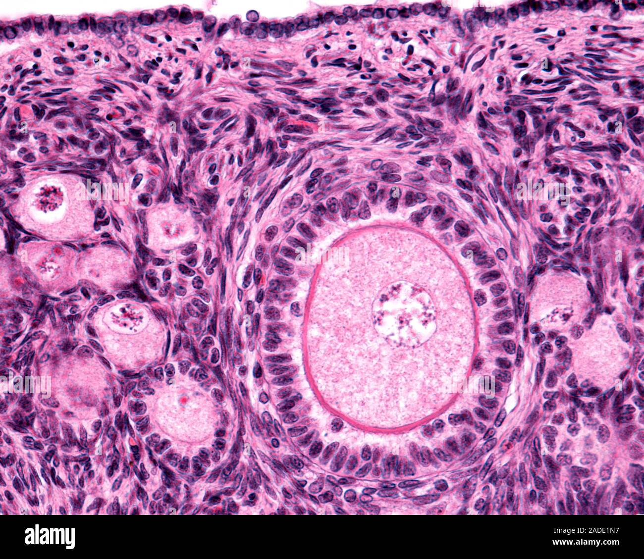 Light micrograph of an ovarian primary follicle showing the oocyte ...