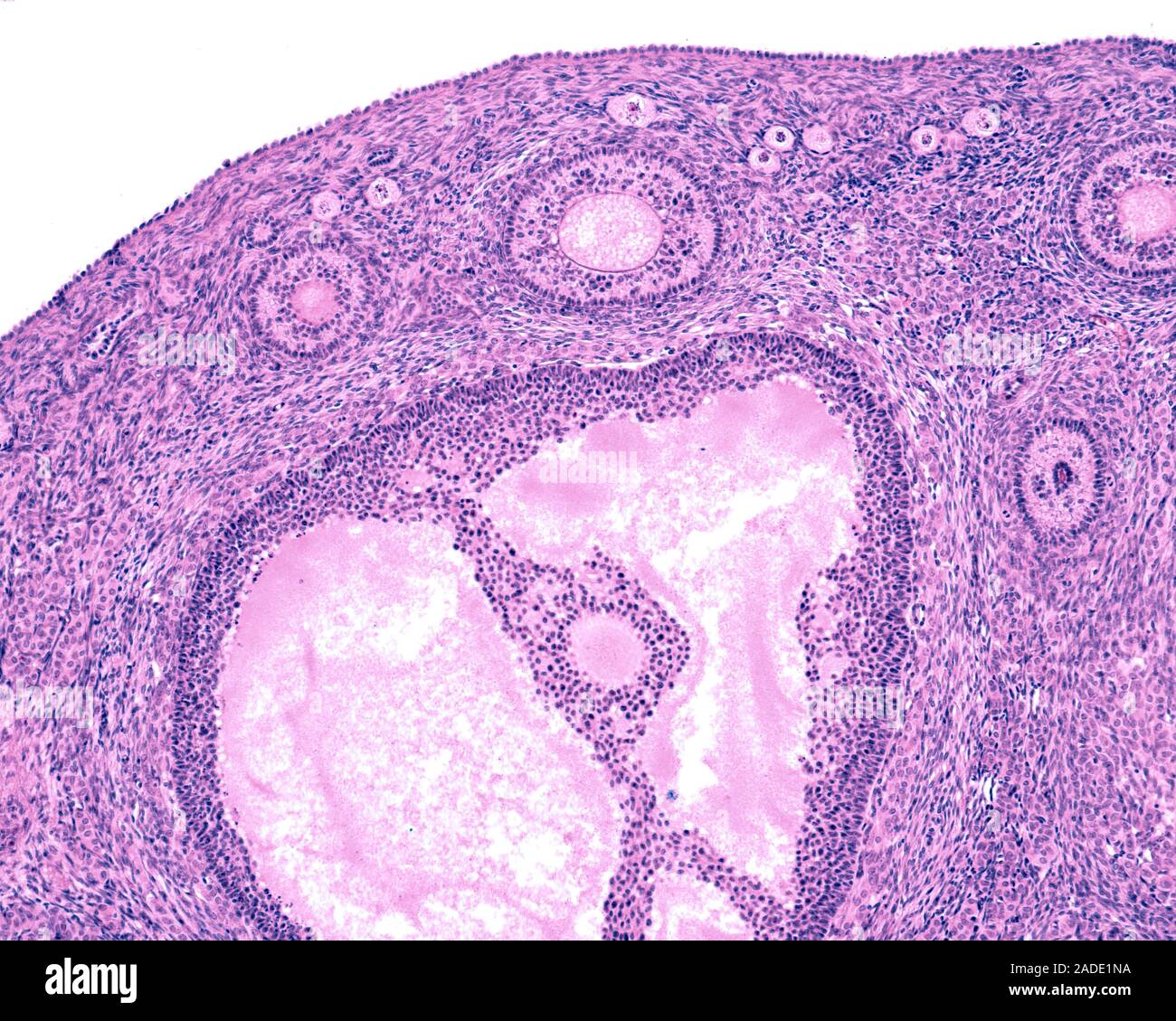 Large ovarian antral follicle or tertiary follicle. In the last phase ...
