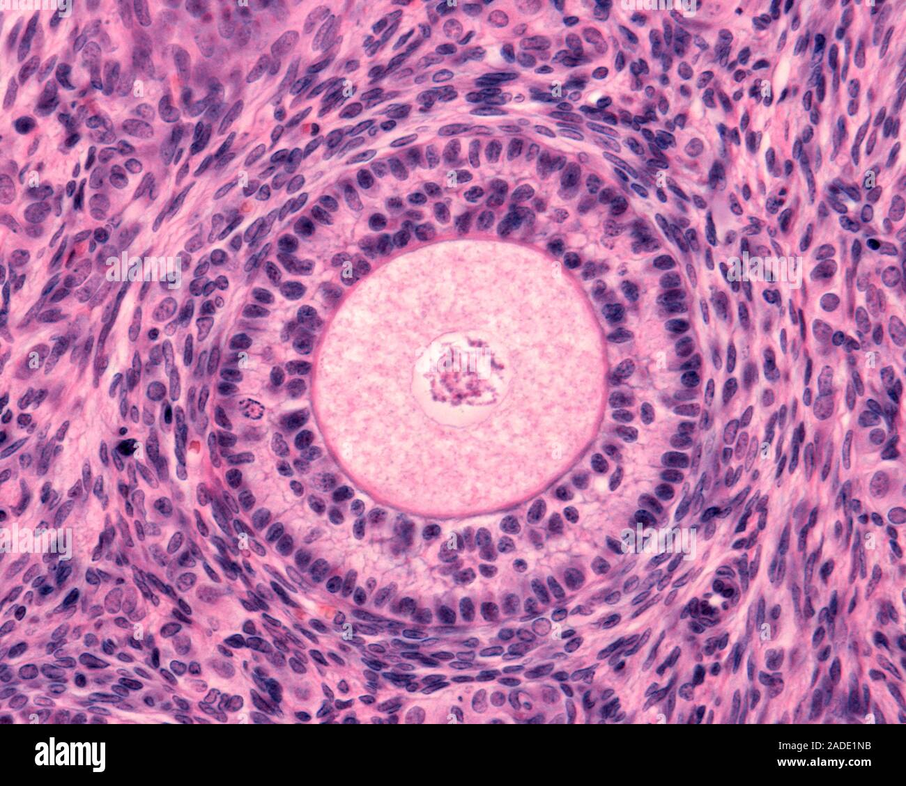 Light micrograph of a secondary follicle showing oocyte, zona pellucida ...