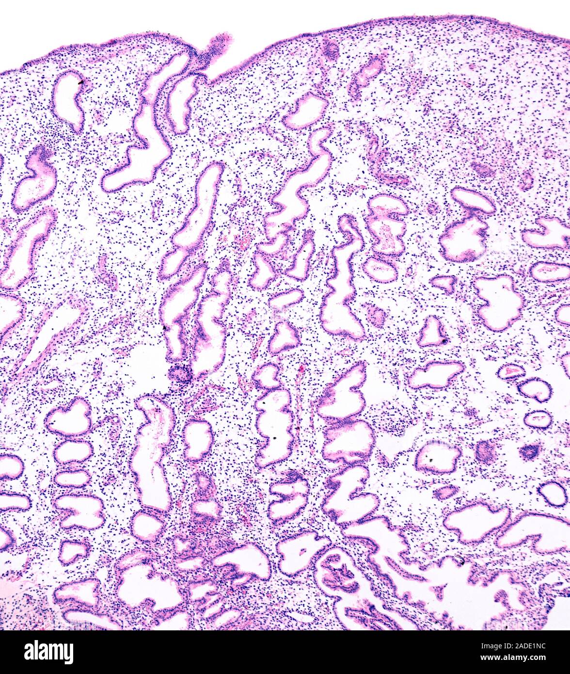 Light micrograph of an endometrium in an advanced secretory phase. The ...