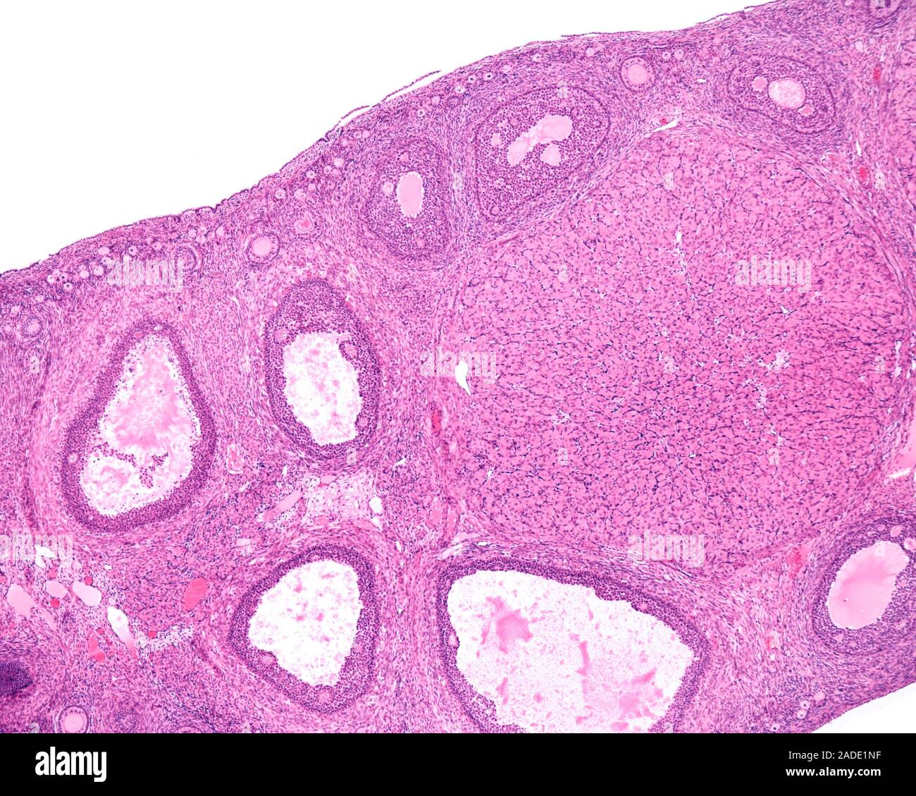 Low magnification light micrograph of a rabbit ovary showing a corpus ...