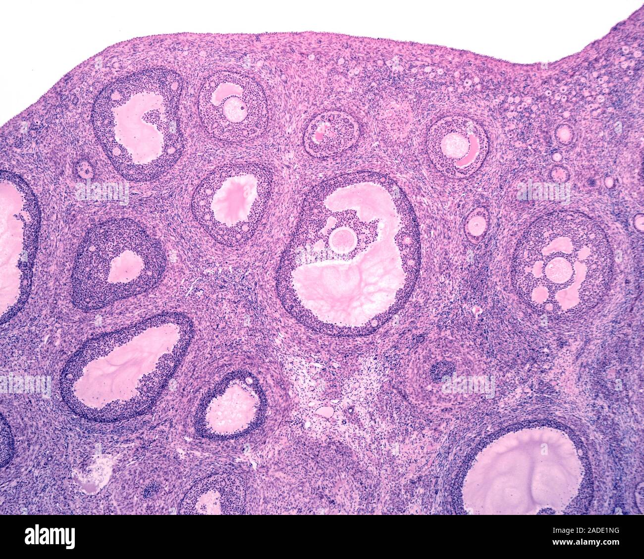 Low magnification light micrograph of a rabbit ovary showing the ...