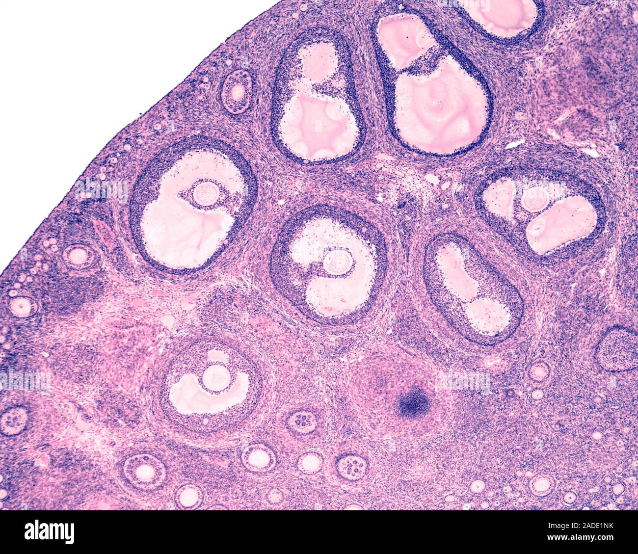 Low magnification light micrograph of a rabbit ovary showing the ...