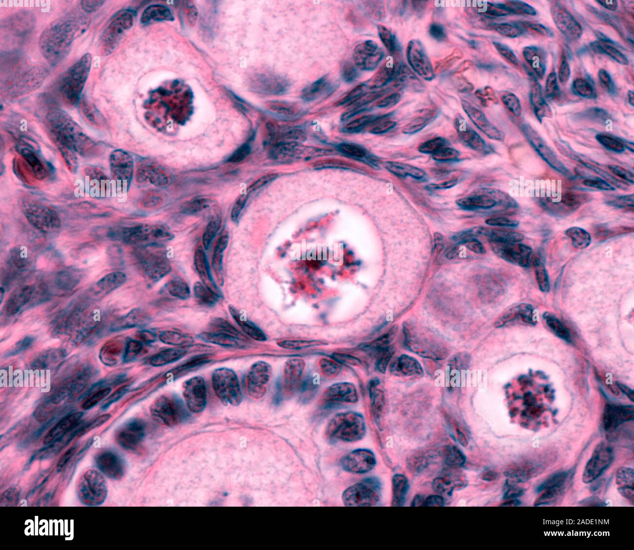 High magnification light micrograph showing a primordial ovarian ...